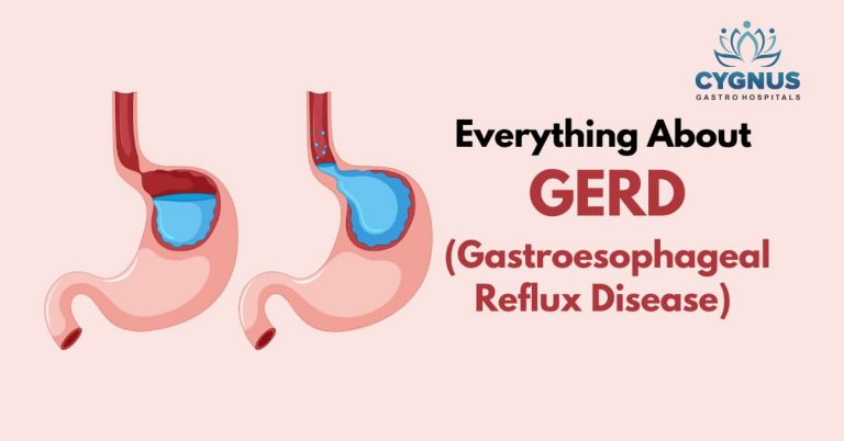 GERD: Risk Factors, Symptoms, Diagnosis and Treatment - Cygnus Gastro ...